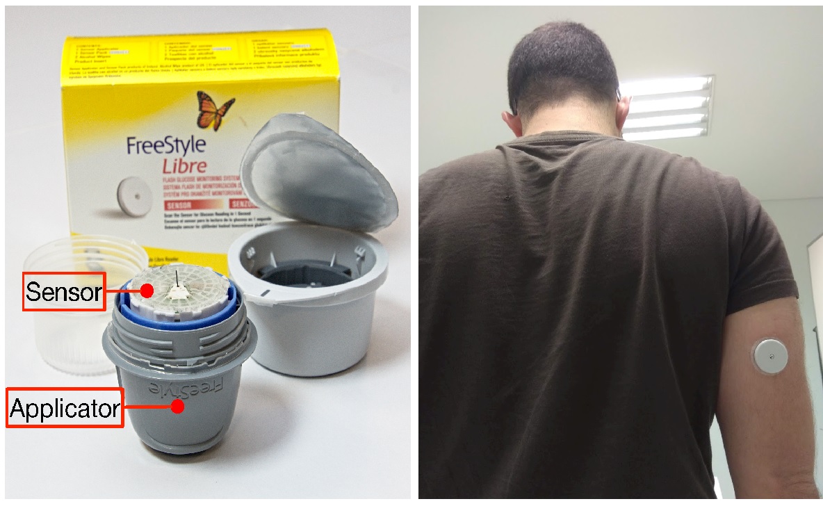 Buy FreeStyle Libre Sensor 1s (Glucose Monitoring | eRomman