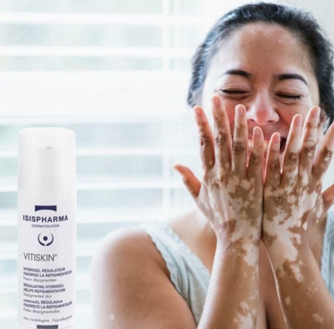 Buy Vitiskin Isispharma 50ml (Vitiligo/Re-Pigmentations) | eRomman